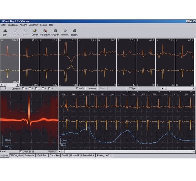 GE Healthcare Seer1000 Holtery EKG – rejestratory - medipment.pl