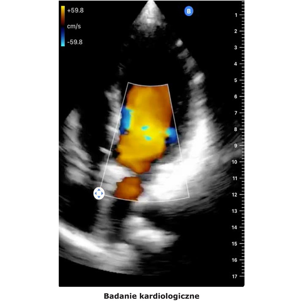 Butterfly iQ+ Ultrasonografy mobilne ręczne (USG) - medipment.pl