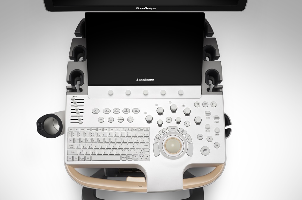 SonoScape P60 Ultrasonografy wielonarządowe - USG - medipment.pl