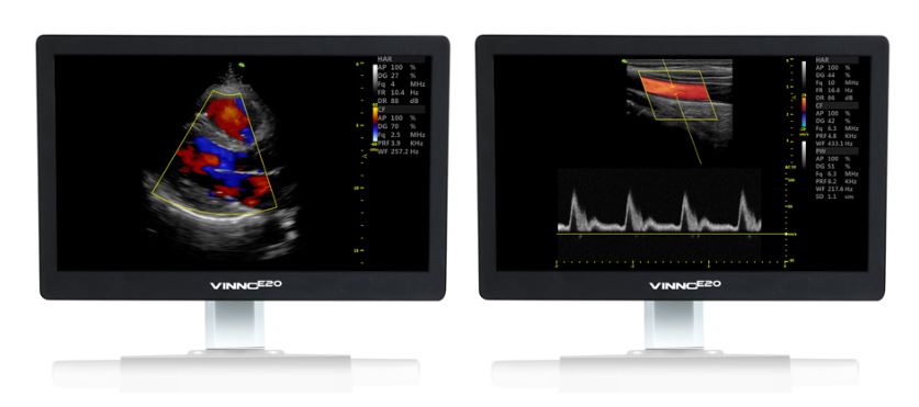 Vinno Vinno E20 Ultrasonografy wielonarządowe - USG - medipment.pl